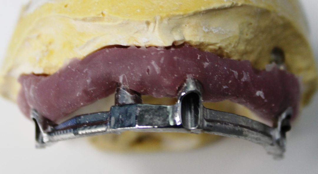 Servicios | Protdentaladvance